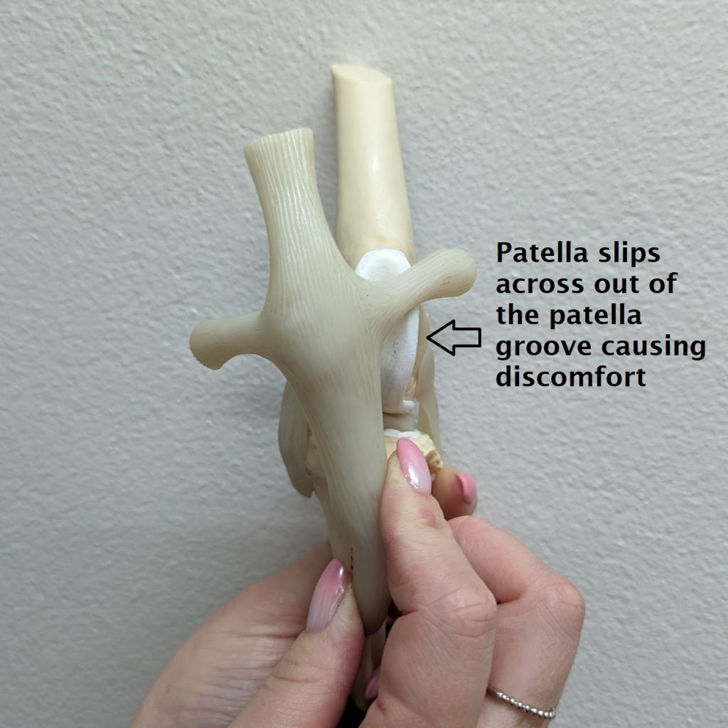 Dislocating Kneecaps (Patella Luxation) - Pittwater Animal Hospital